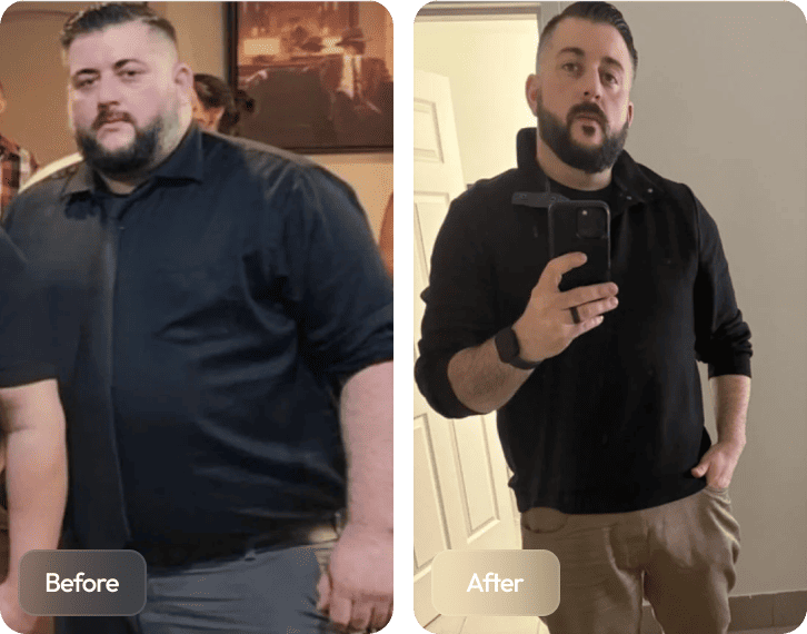 Compounded Tirzepatide Tablets